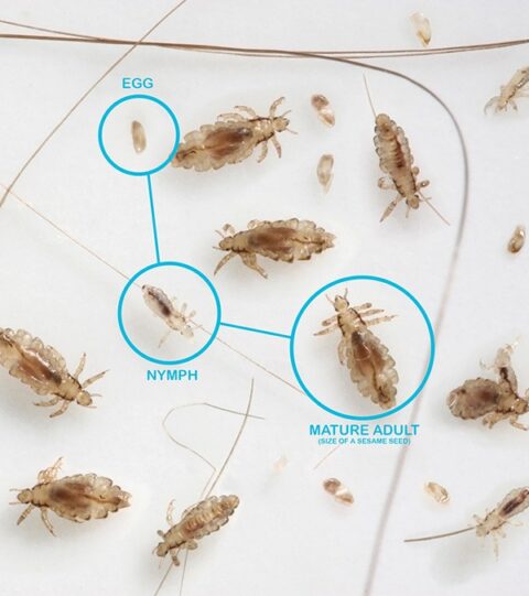 Head Lice Facts